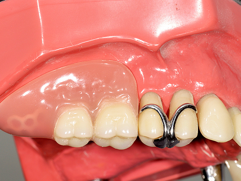 Ästhetische Zahnheilkunde - Dr. Andreas Stein, Zahnarzt, Oralchirurgie ...