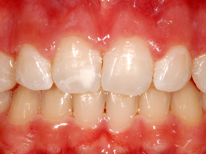 Ästhetische Zahnheilkunde - Dr. Andreas Stein, Zahnarzt, Oralchirurgie ...